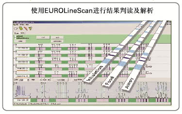EUROLineScan欧蒙印迹法判读软件-欧蒙中国