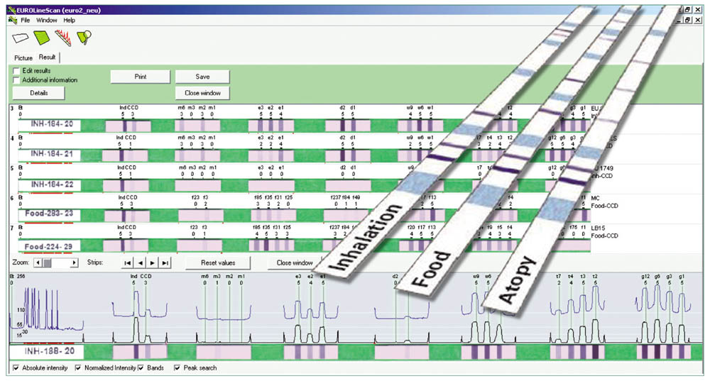印迹法判读软件 EUROLineScan-欧蒙中国